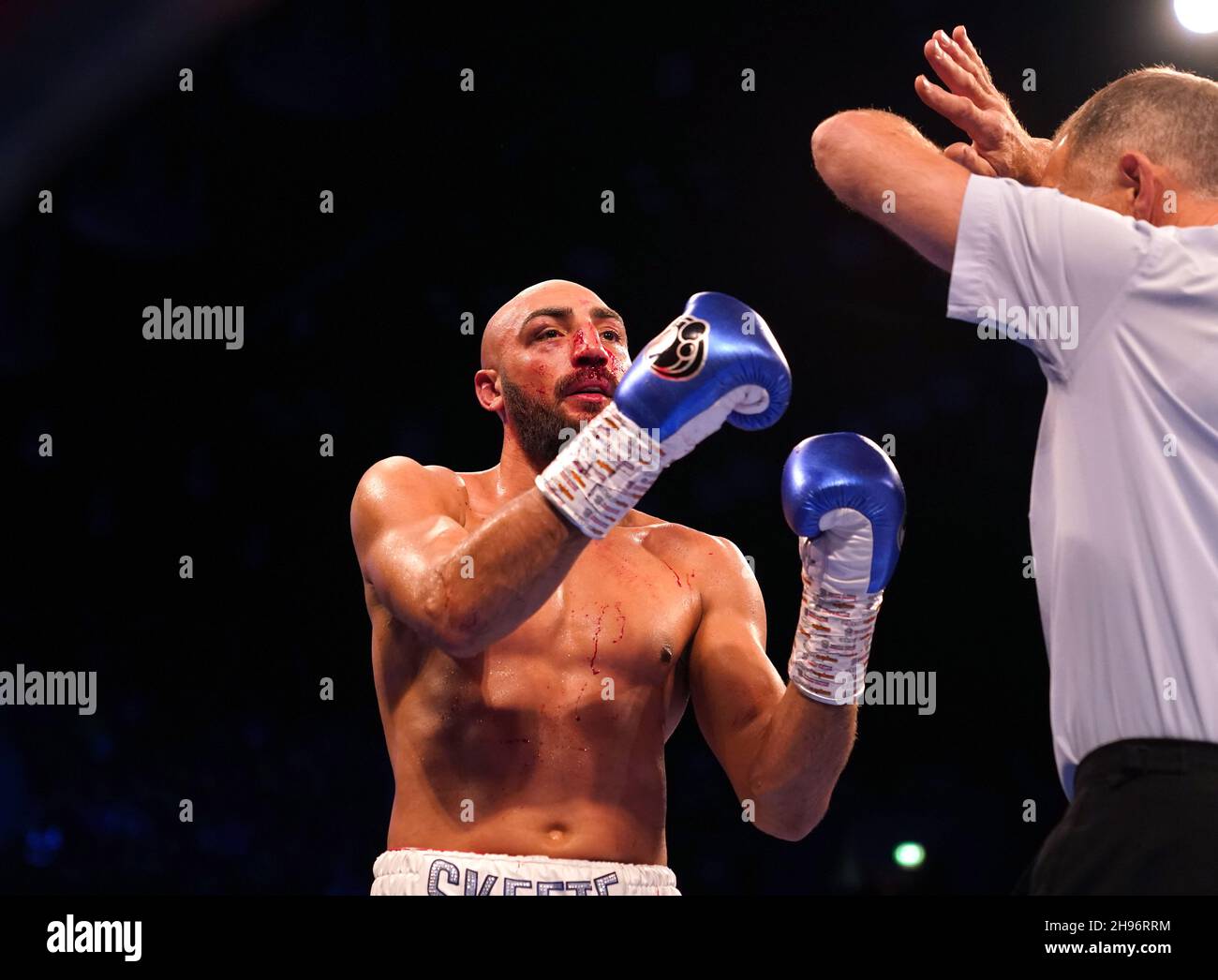 Bradley Skeete reacts after defeat in the World Boxing Organisation ...
