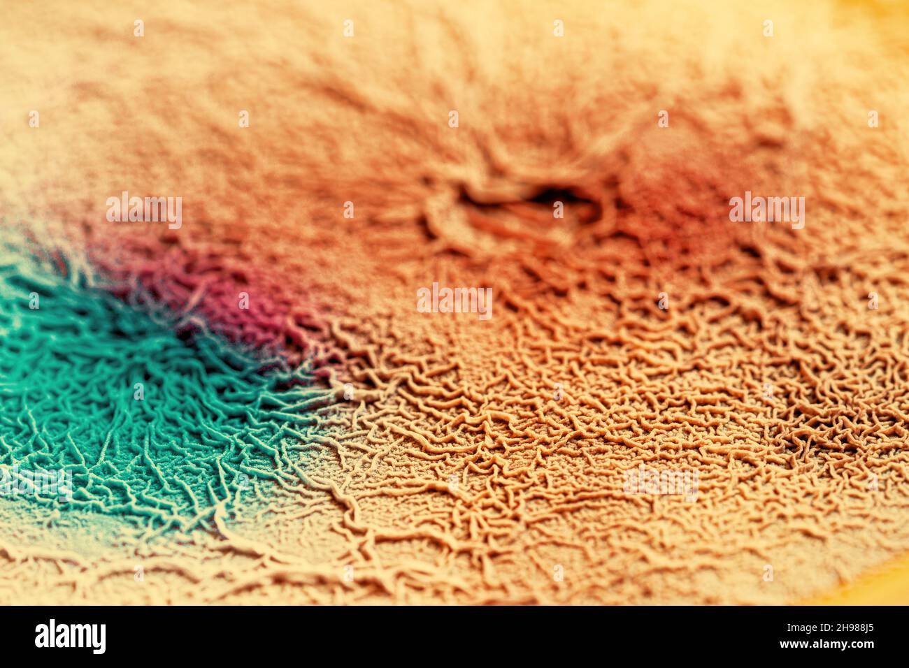 The tissue of a biological organism is affected by two types of cancer ...