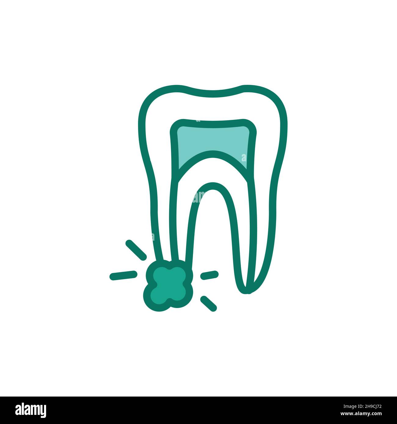 Cyst of tooth Stock Vector Images - Alamy