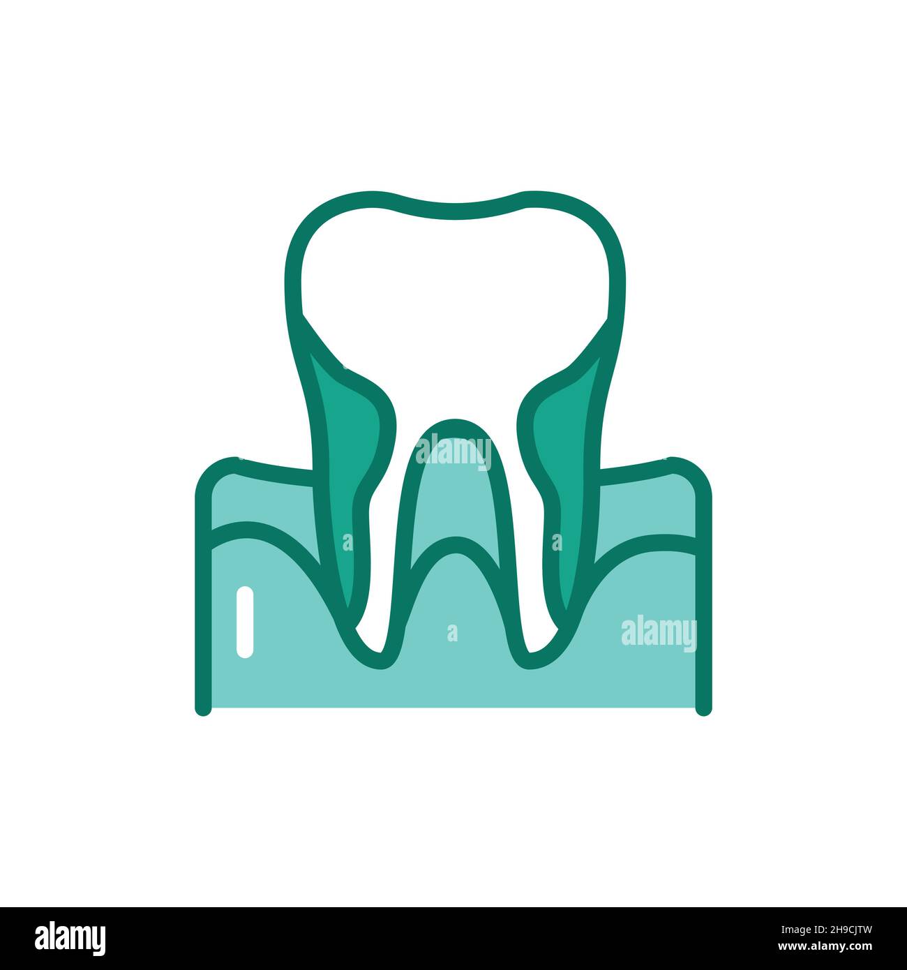 Periodontitis illustration Stock Vector Images - Alamy