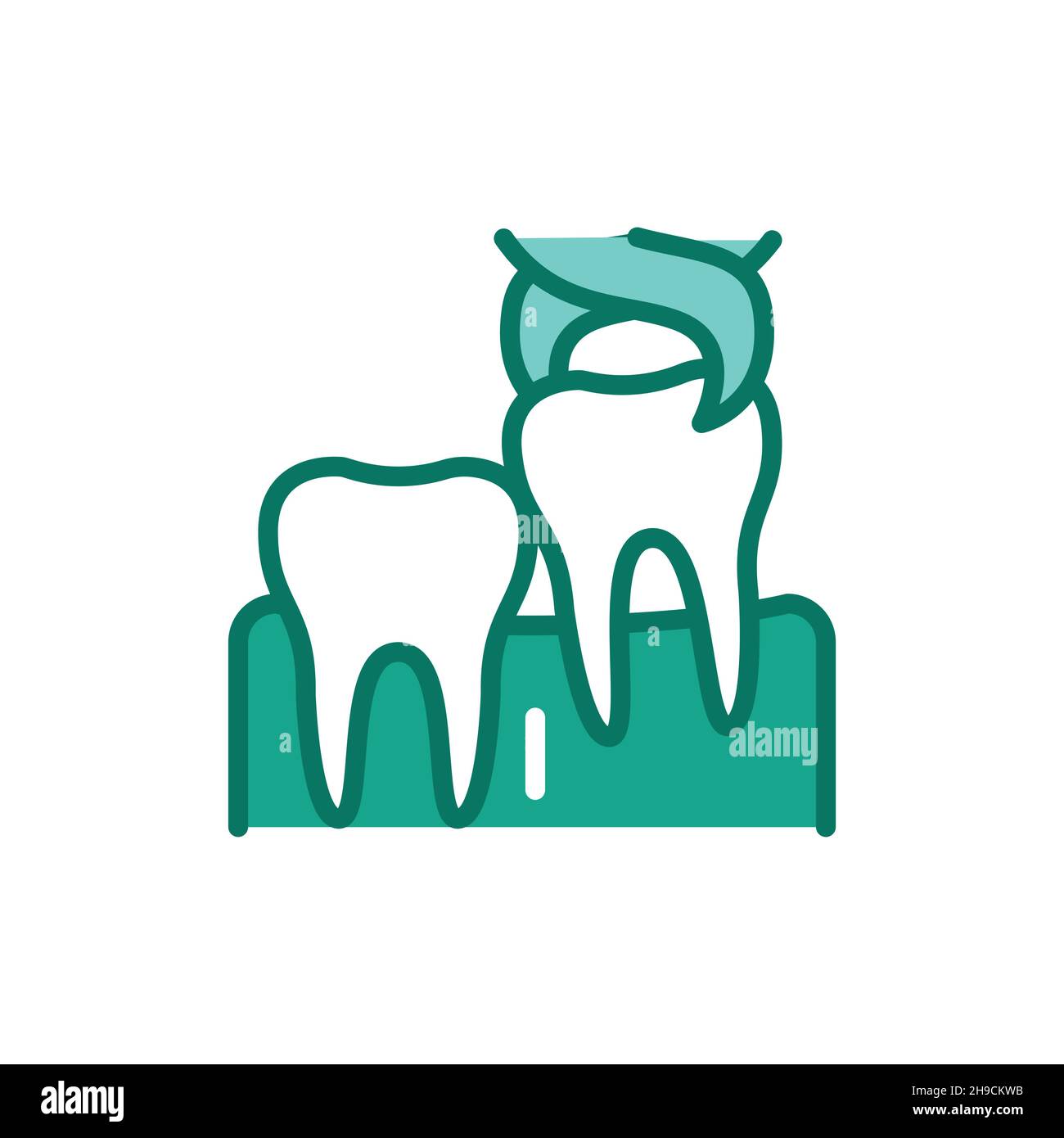 Wisdom tooth extraction color line icon. Isolated vector element ...