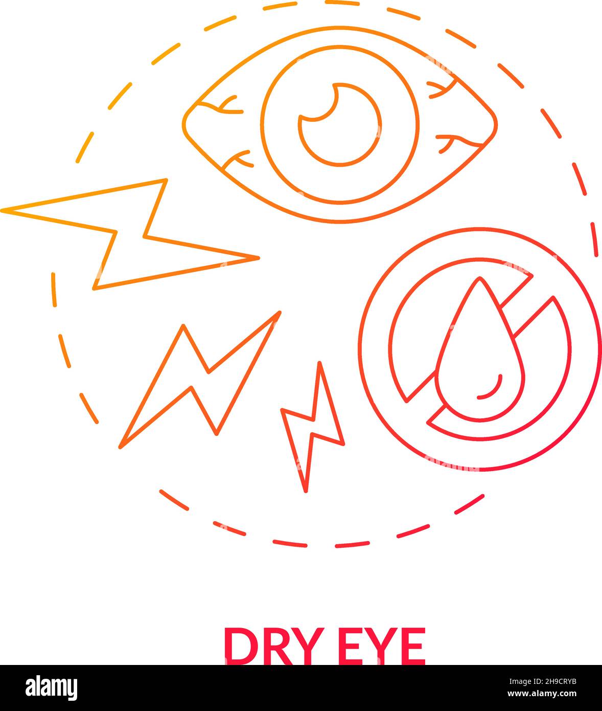 Dry eye cornea Stock Vector Images - Alamy