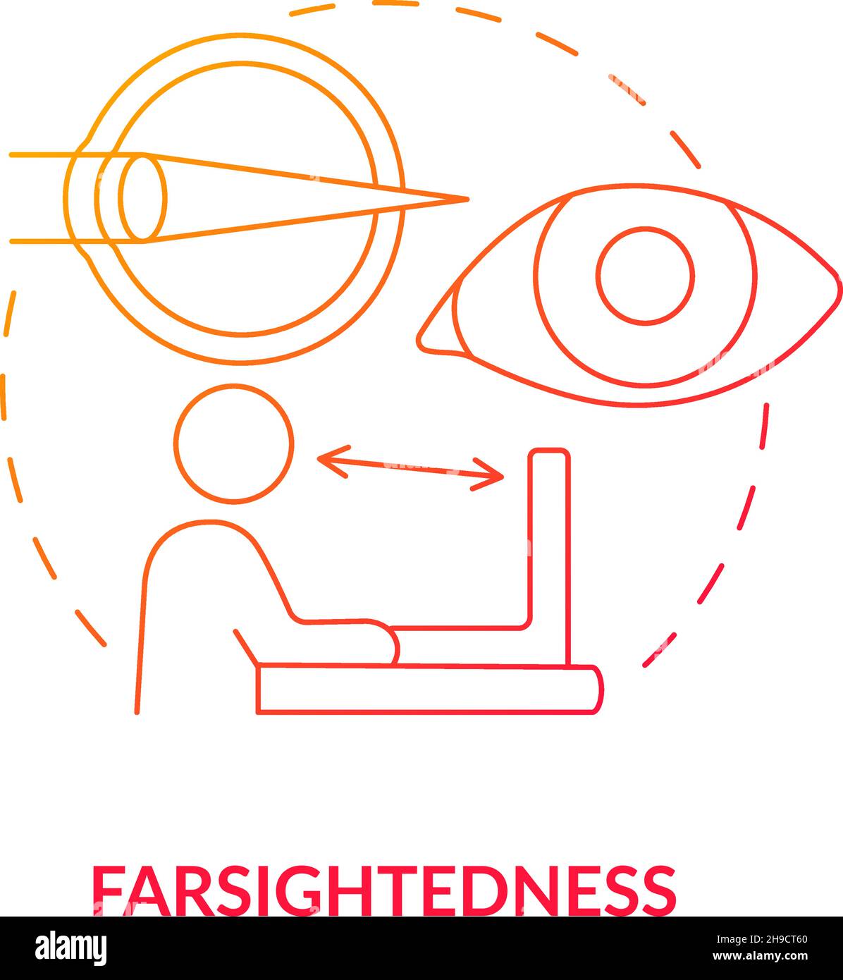 Hyperopia drawing hi-res stock photography and images - Alamy