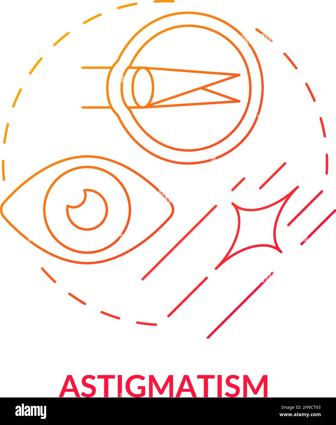 Astigmatism drawing hi-res stock photography and images - Alamy
