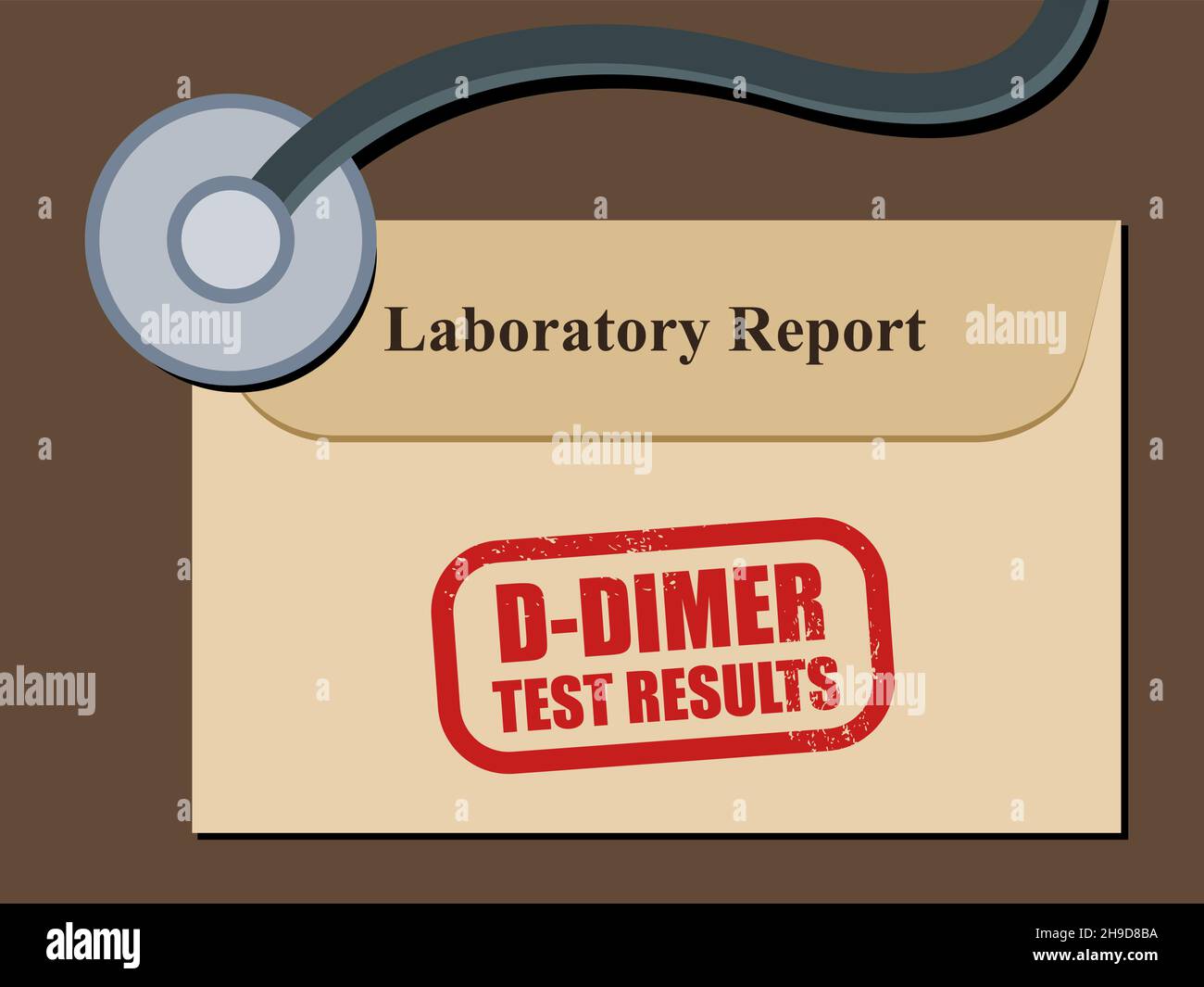 D-Dimer bloodwork laboratory test results. Health concept. Medical ...