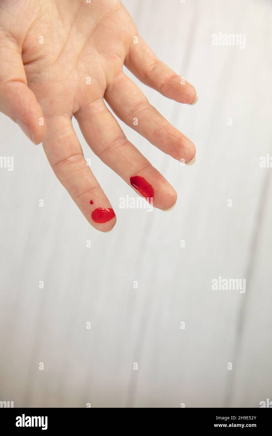 hand injury with blood, blood wound cut top view, copy space, medical ...