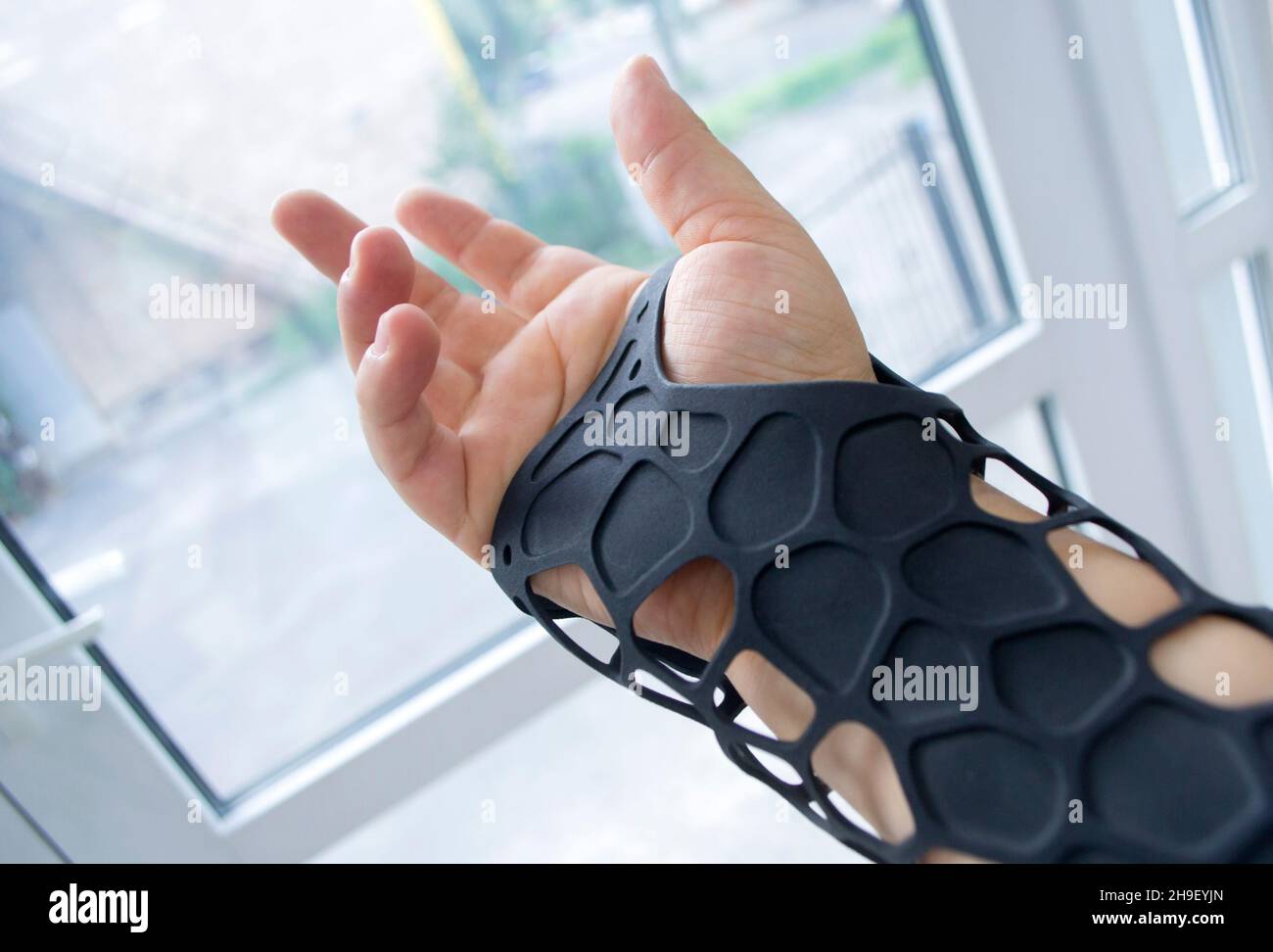 Black orthopedic plastic prosthesis printed on powder 3D printer on ...
