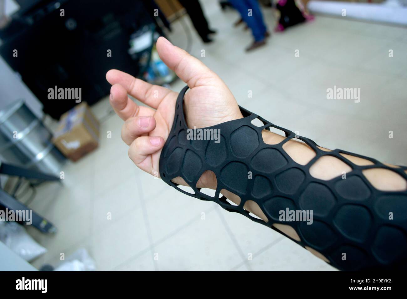 Black orthopedic plastic prosthesis printed on powder 3D printer on ...