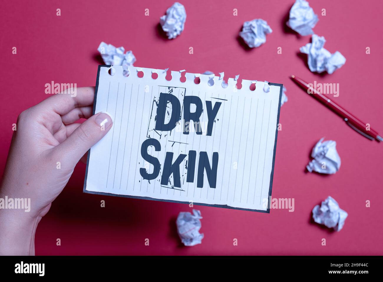 Text caption presenting Dry Skin. Concept meaning uncomfortable ...