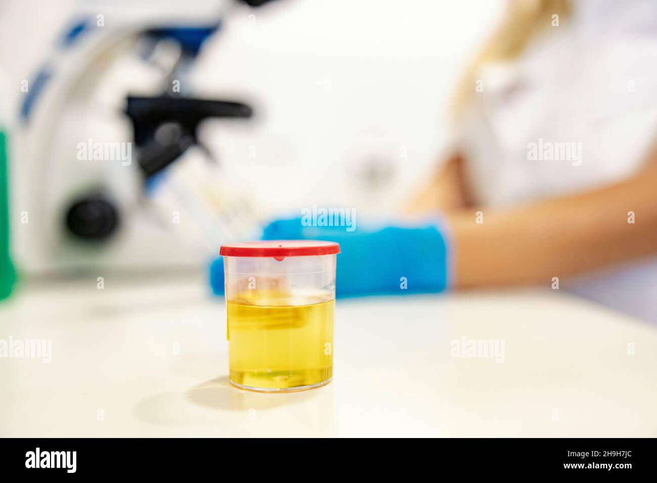 A bottle with a urine sample. HIV and pathogen virus discovery. A ...