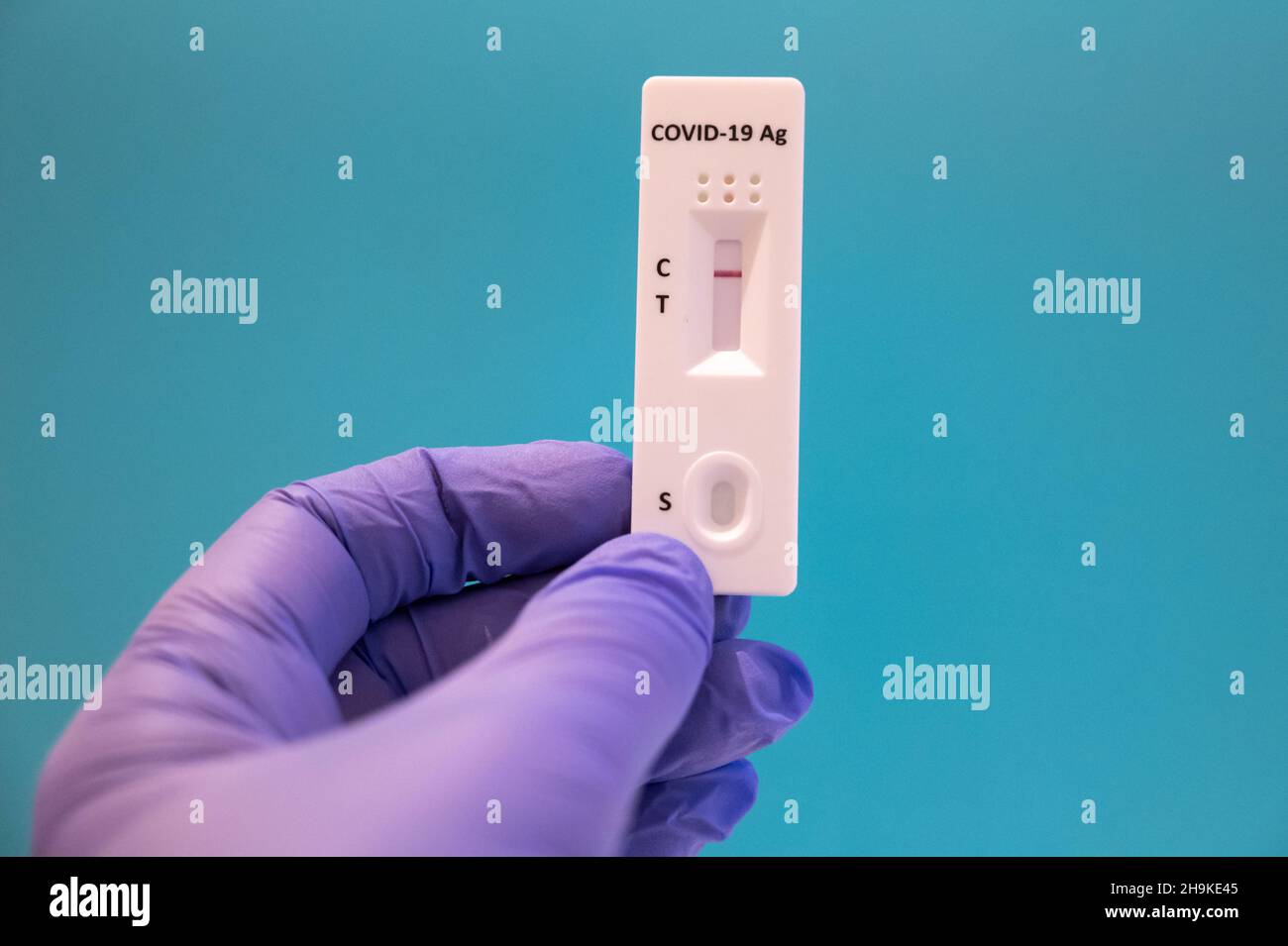 A negative result in an antigen test (rapid test device) for the ...