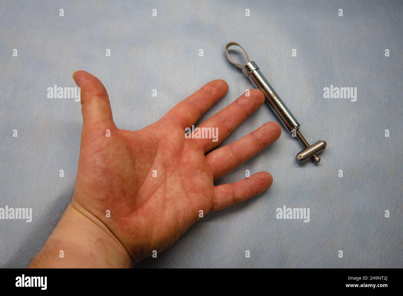 Tourniquet surgery hi-res stock photography and images - Alamy