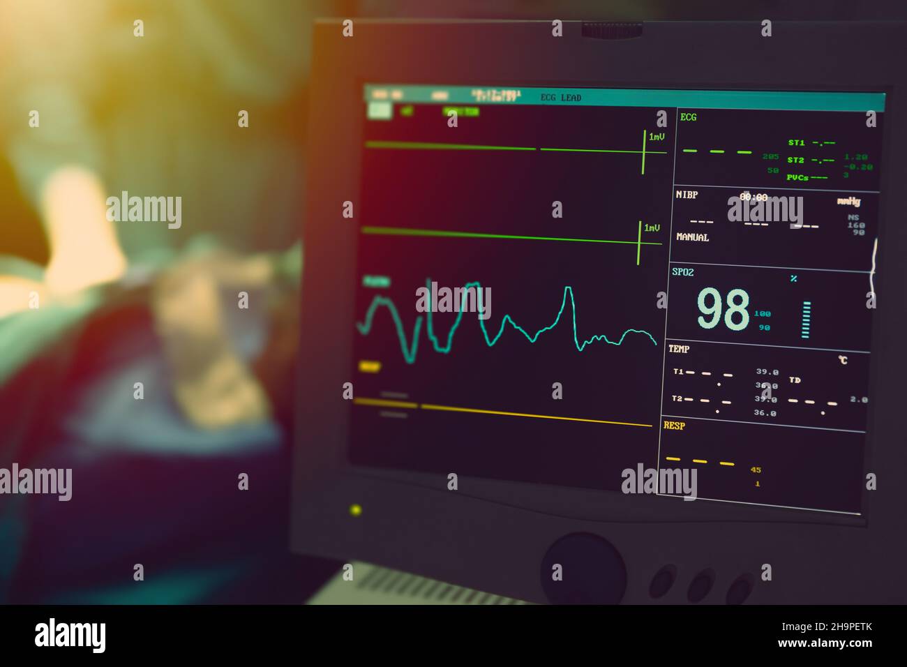 Heart rate ECG pulse monitor screen for surgery operation room in ...