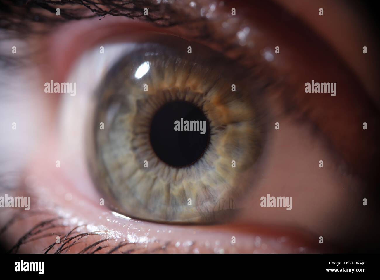 Laser vision correction hi-res stock photography and images - Alamy