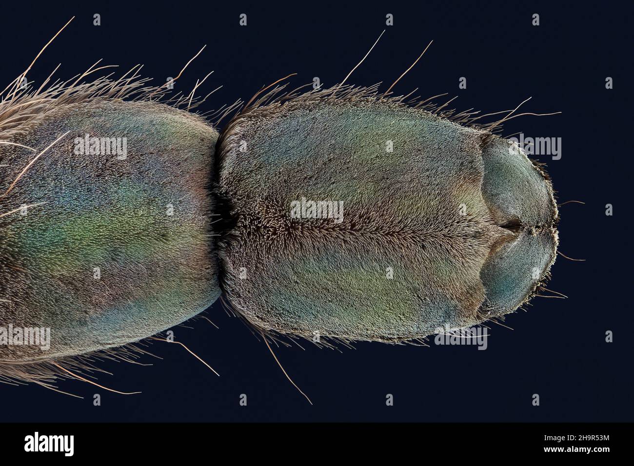 Underside of foot hi-res stock photography and images - Alamy