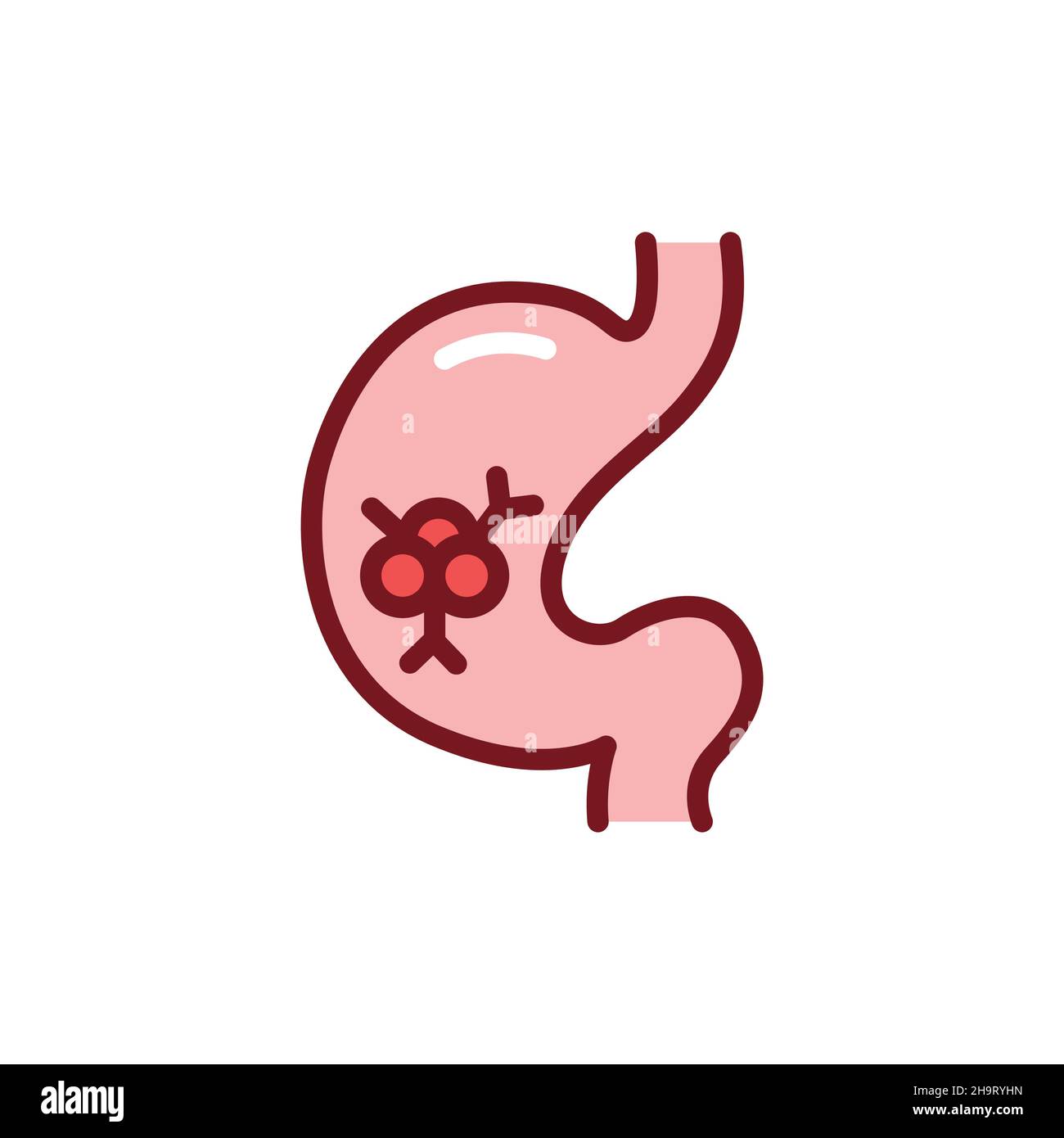 Cancer progression hi-res stock photography and images - Alamy