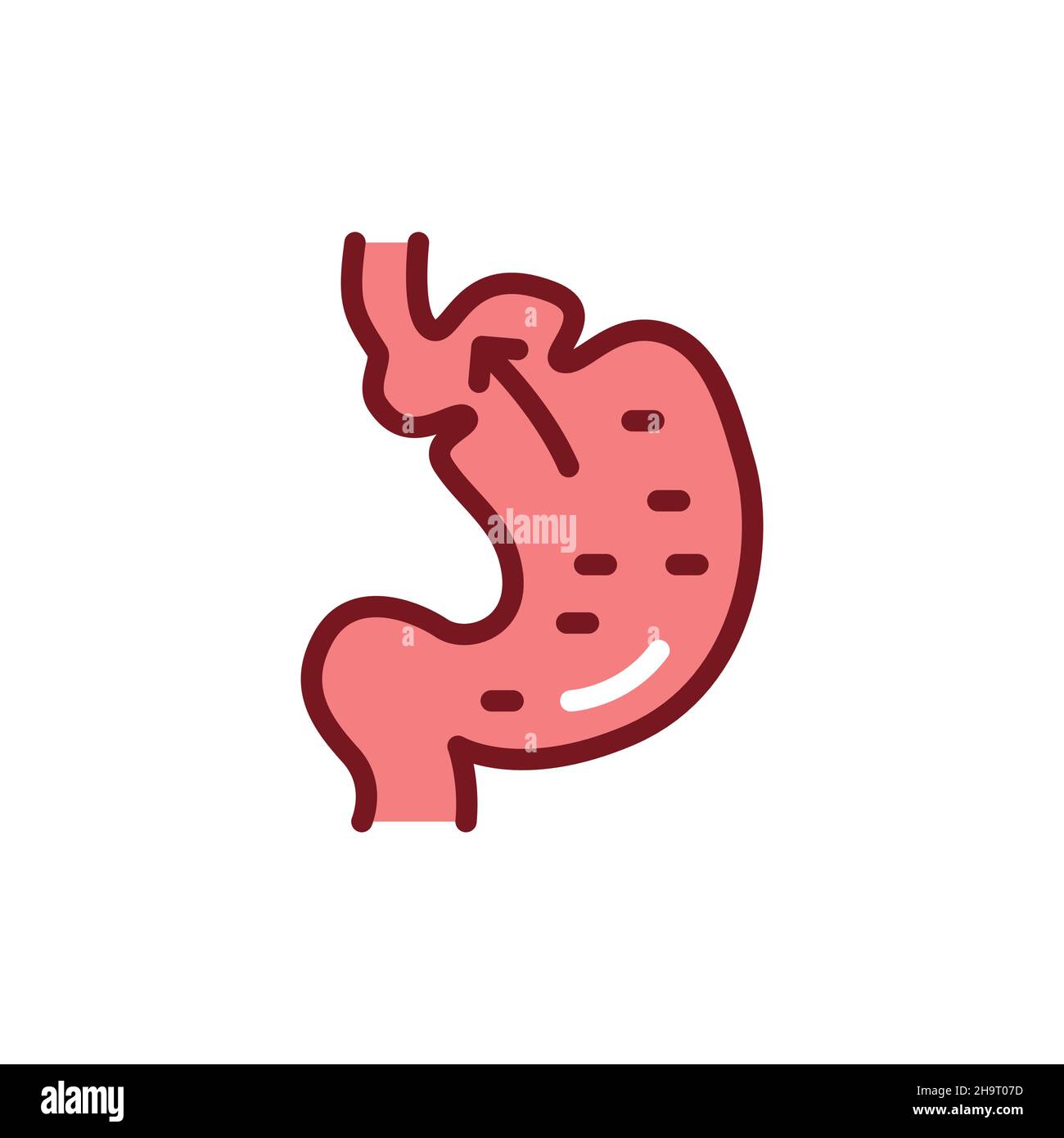 Hiatal hernia drawing hi-res stock photography and images - Alamy