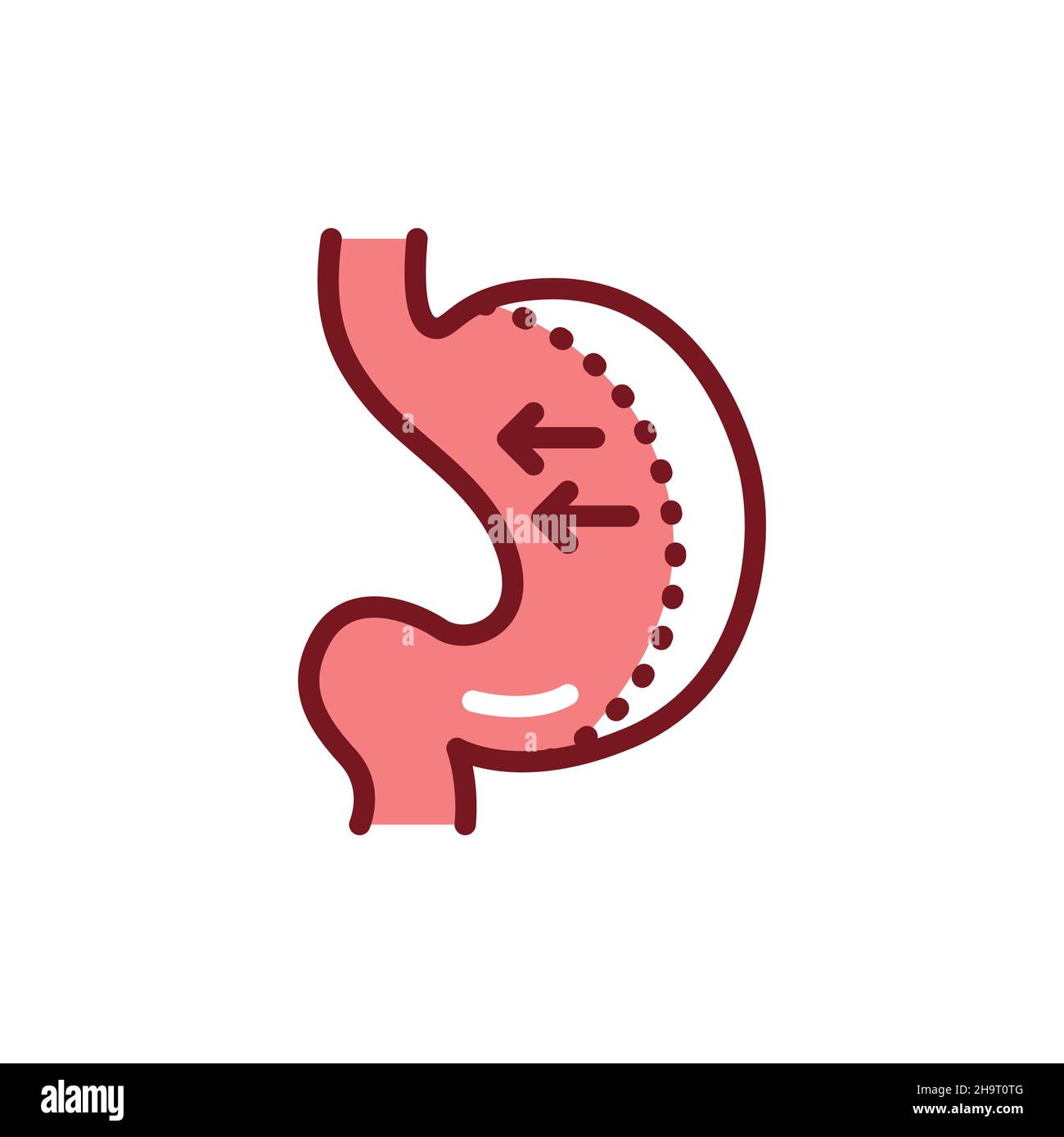 Gastrectomy Stock Vector Images - Alamy