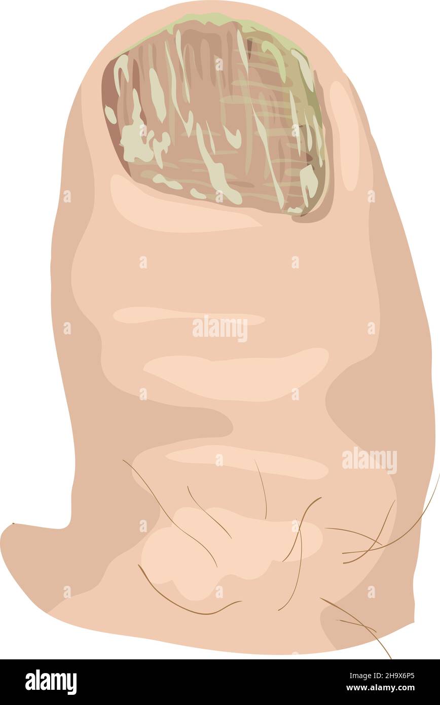 Foot cut out Stock Vector Images - Alamy