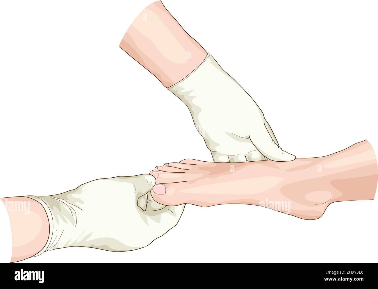 Examination of the foot. Vector illustration Stock Vector Image & Art ...