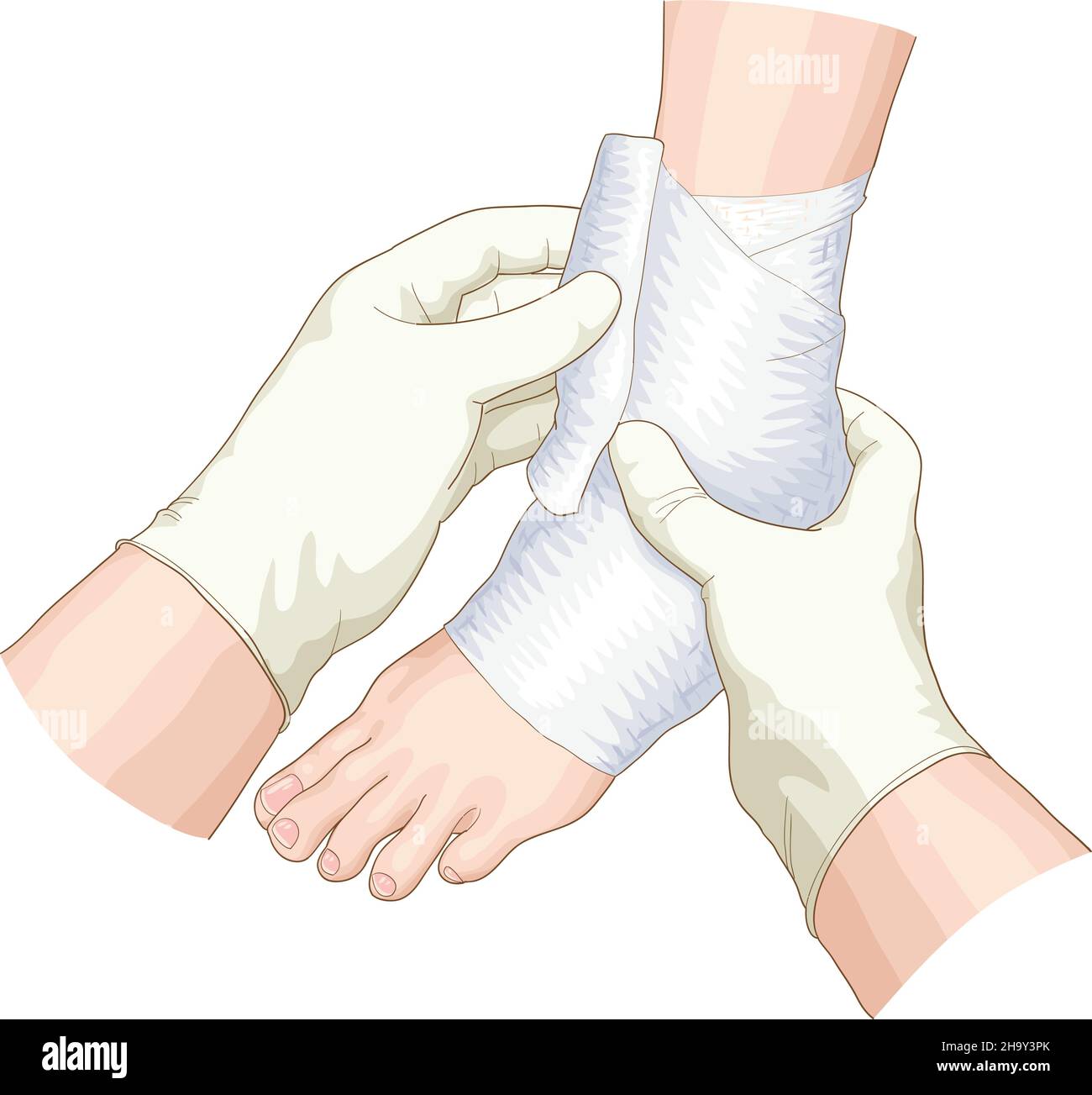 Orthopedic leg joint bandage Stock Vector Images - Alamy