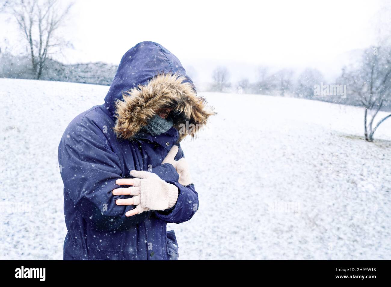 Chilblains hi-res stock photography and images - Alamy