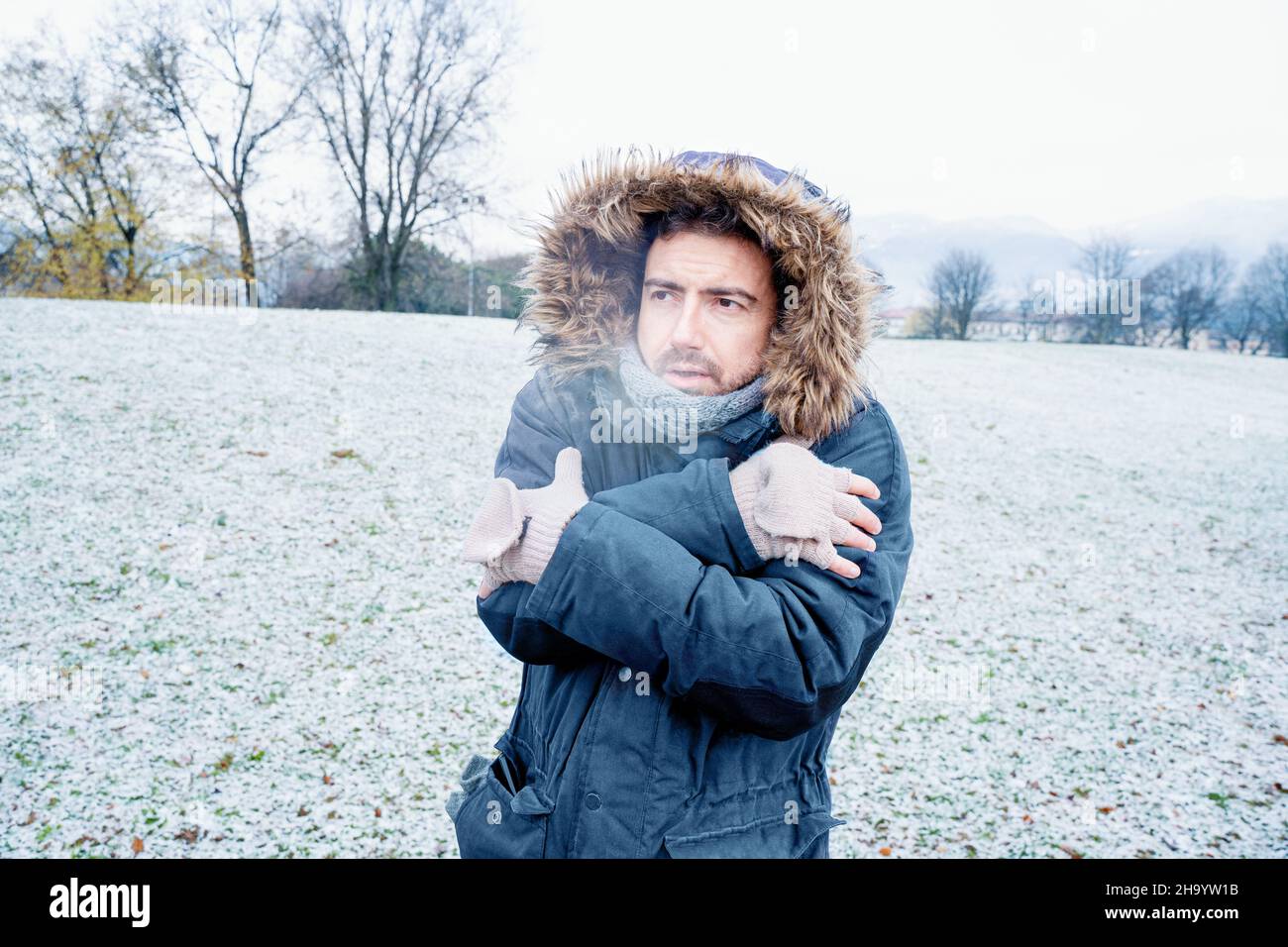 Chilblains hi-res stock photography and images - Alamy