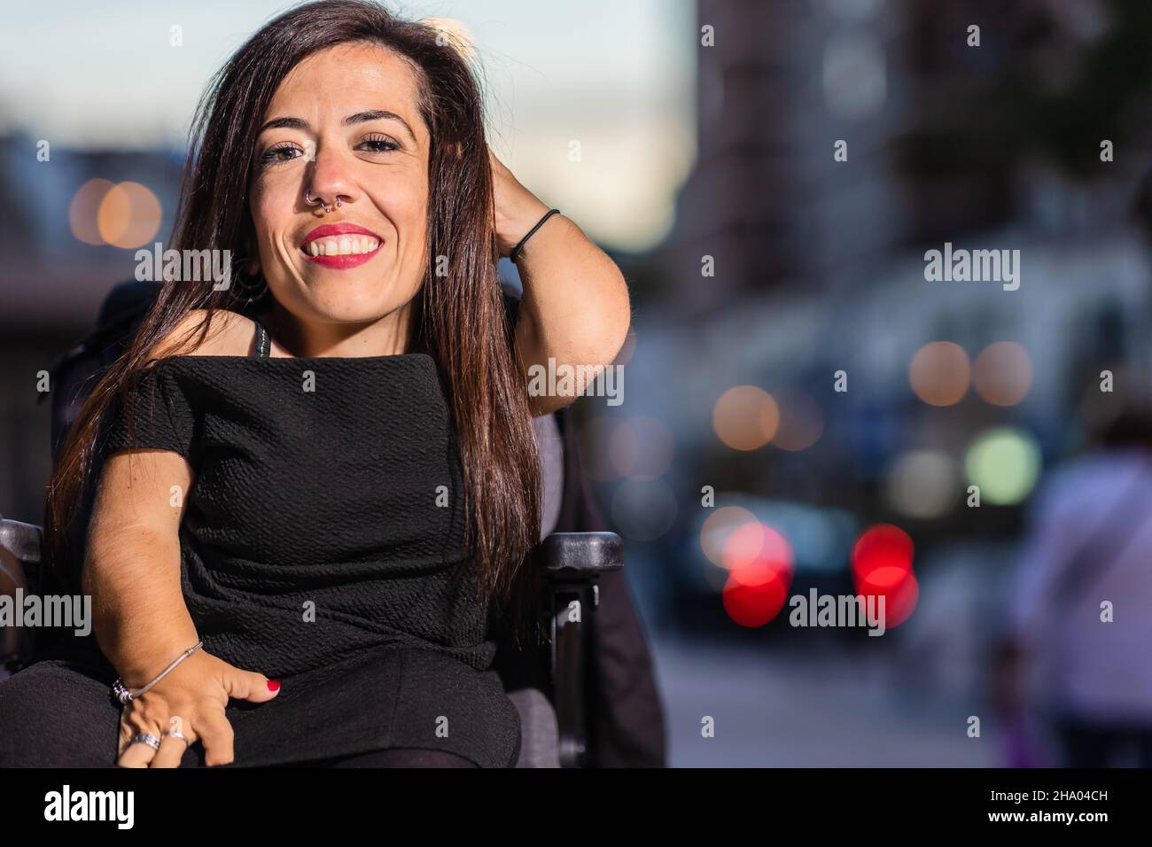 Person with Dysplasia with a chronic health condition disability ...