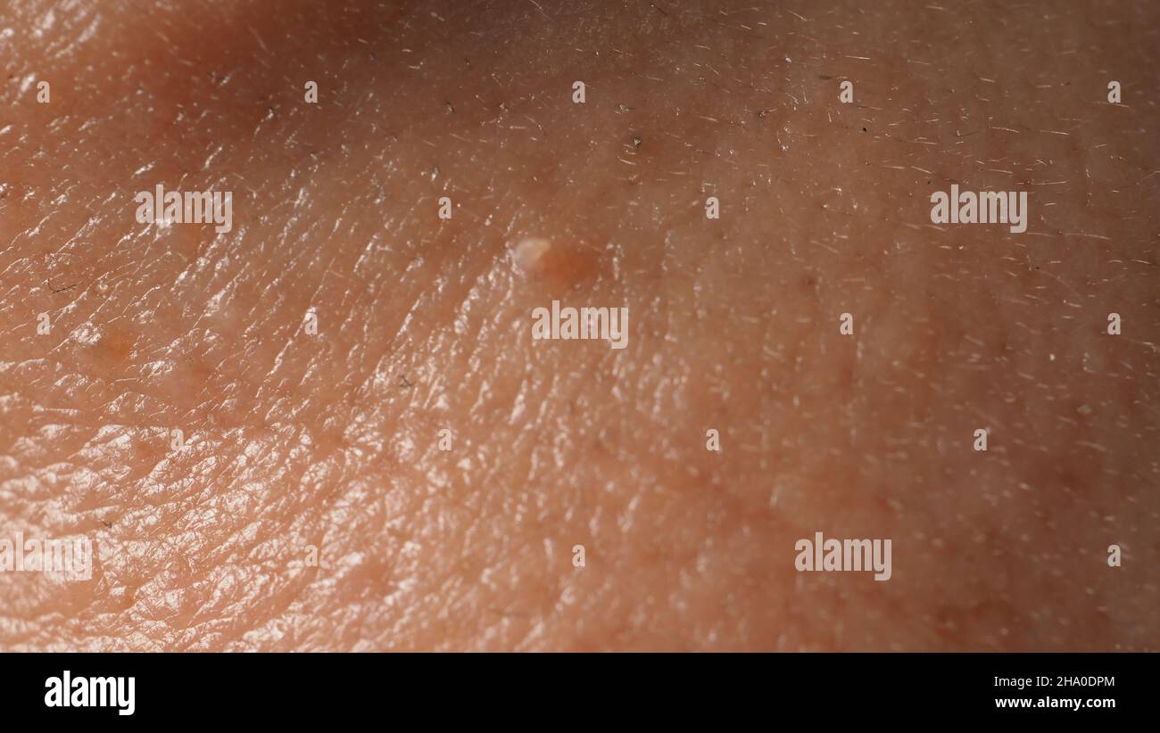 Skin Texture On The Nose High Resolution Stock Photography and Images ...