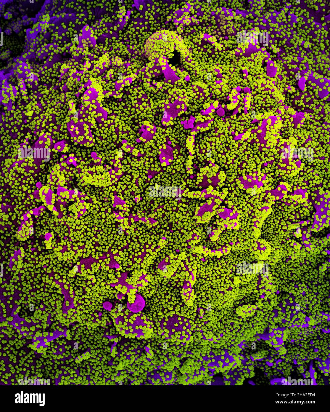 Colorized scanning electron micrograph of a cell (purple) heavily ...
