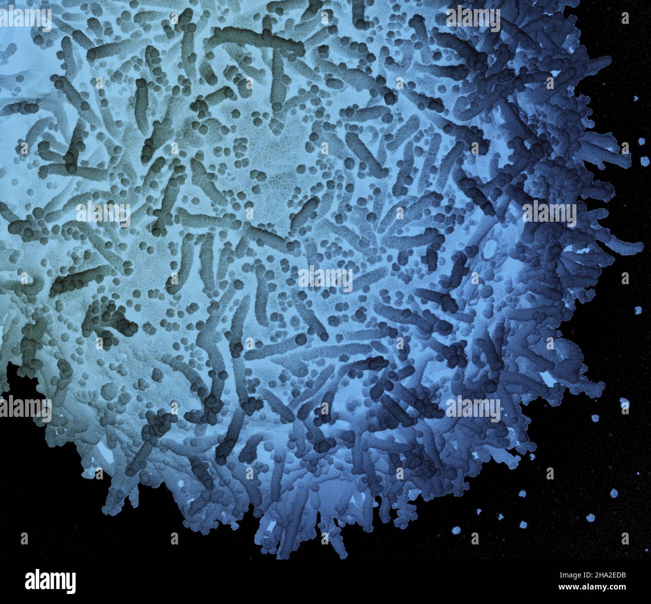 Color-enhanced scanning electron micrograph of a cell infected with ...