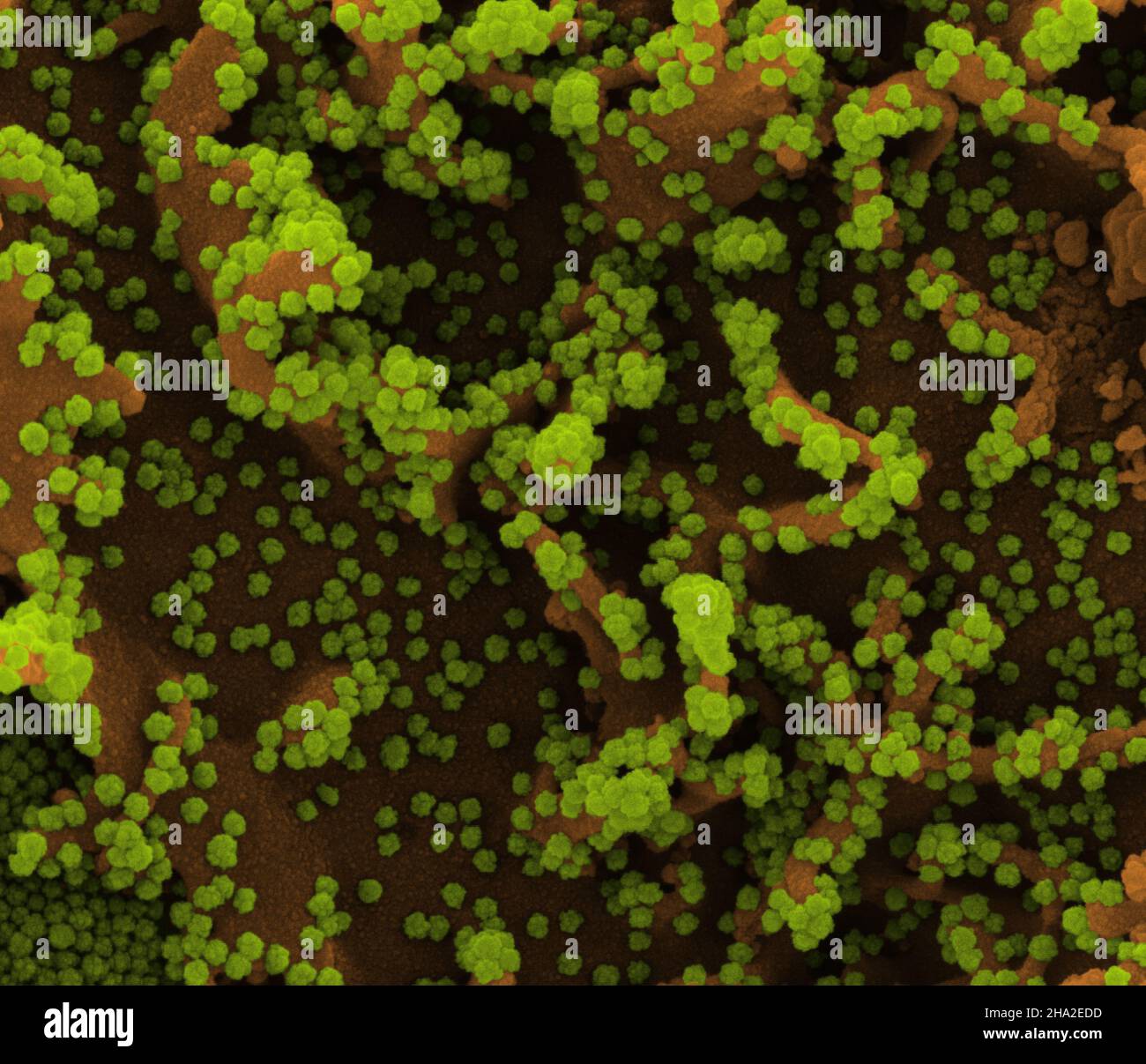 Colorized scanning electron micrograph of a cell (brown) heavily ...