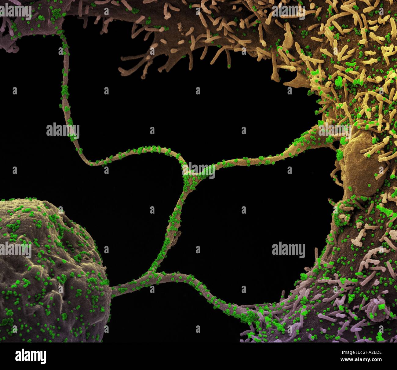 Colorized scanning electron micrograph of CCL-81 Cells infected with ...