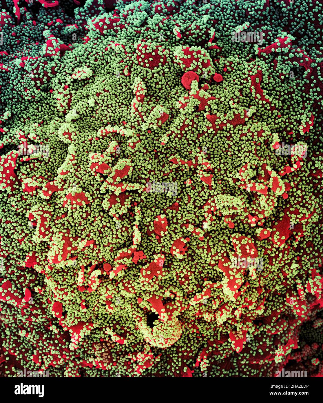 Colorized scanning electron micrograph of a cell (red) heavily infected ...