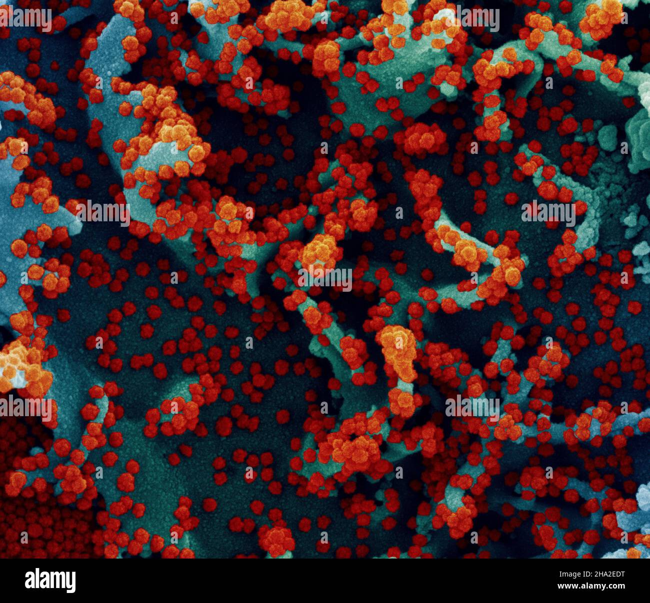 Colorized scanning electron micrograph of a cell heavily infected with ...