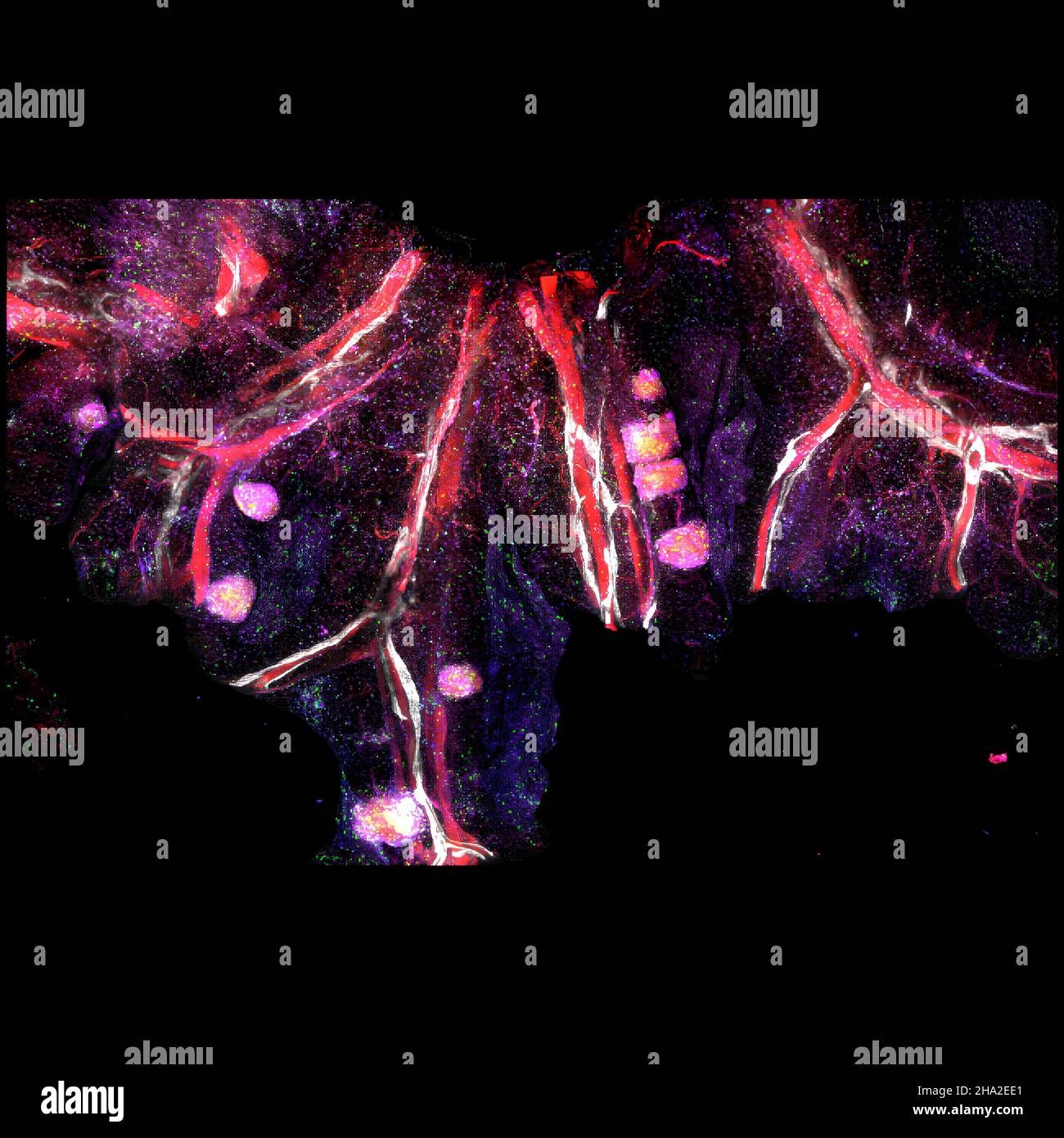 Mesenteric adipose tissue 4 days post yersinia pseudotuberculosis ...