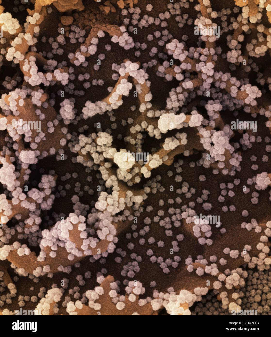 Colorized scanning electron micrograph of a cell (brown) heavily ...