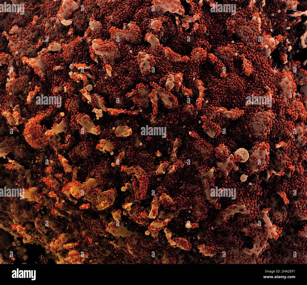 Colorized scanning electron micrograph of a cell (brown) heavily ...
