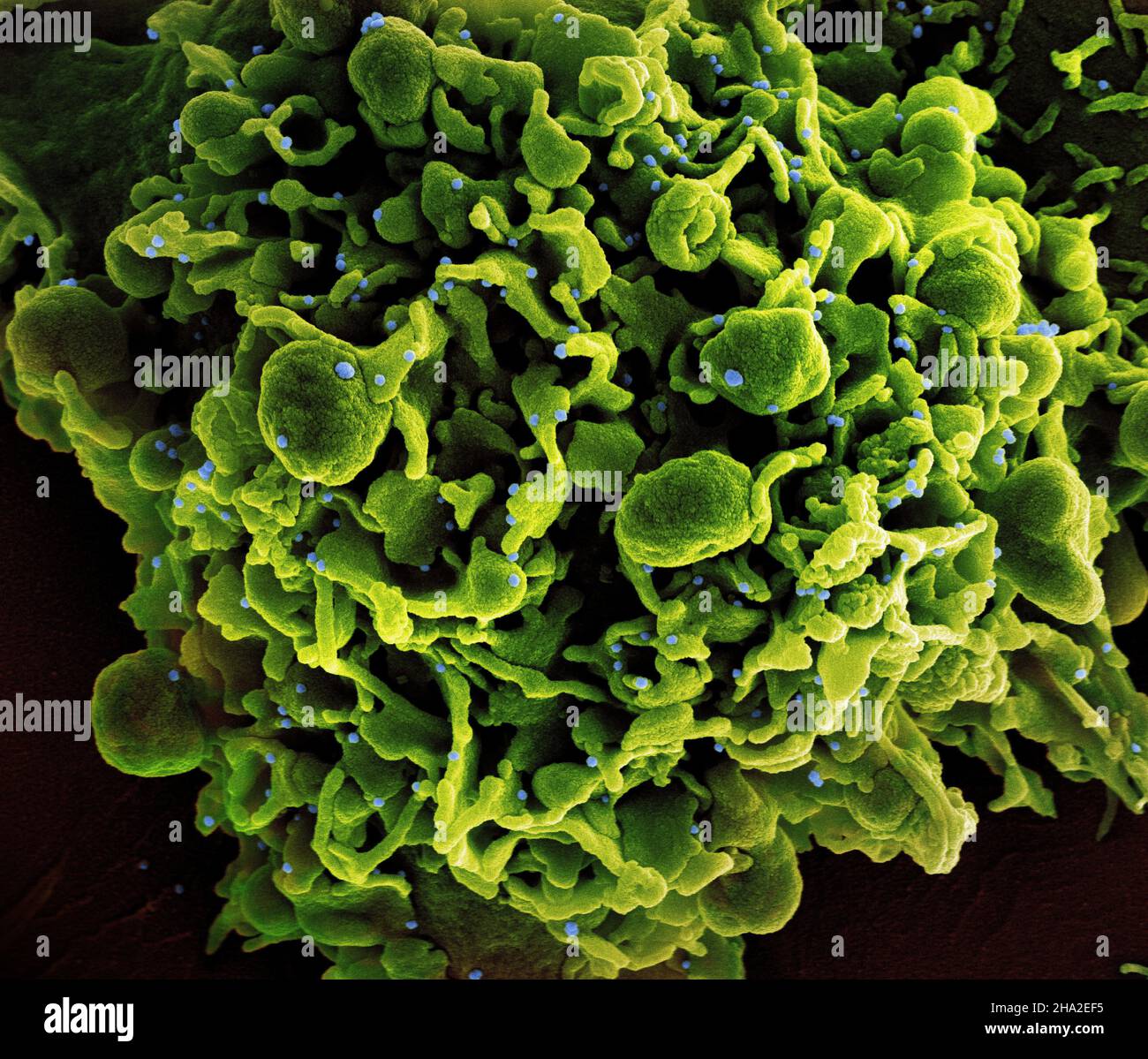 Colorized scanning electron micrograph of a cell (green) infected with ...