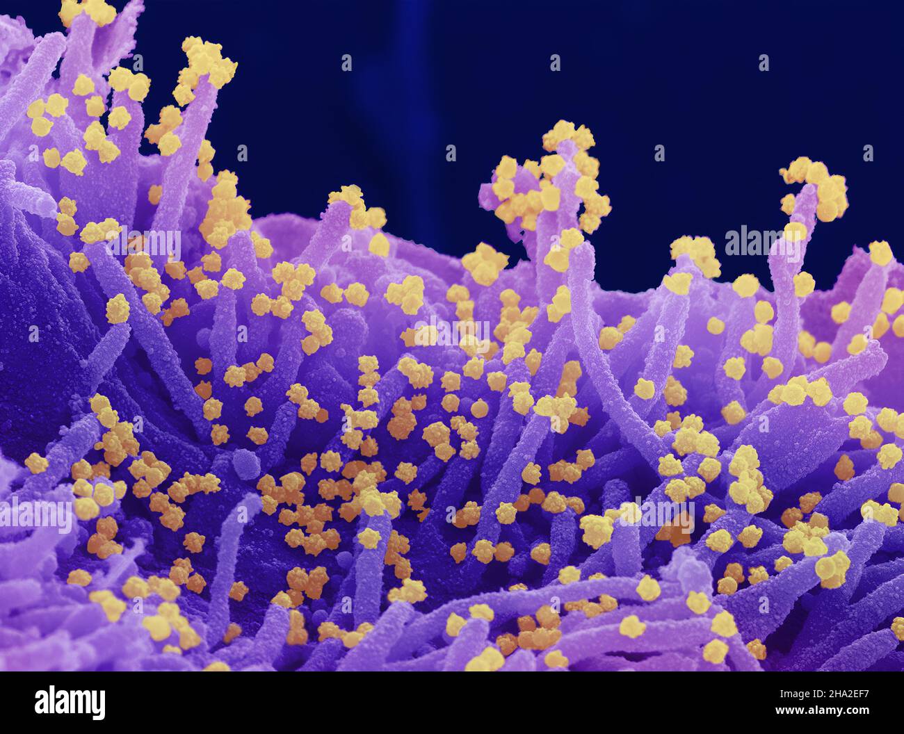 This scanning electron microscope image shows SARS-CoV-2 (round gold ...
