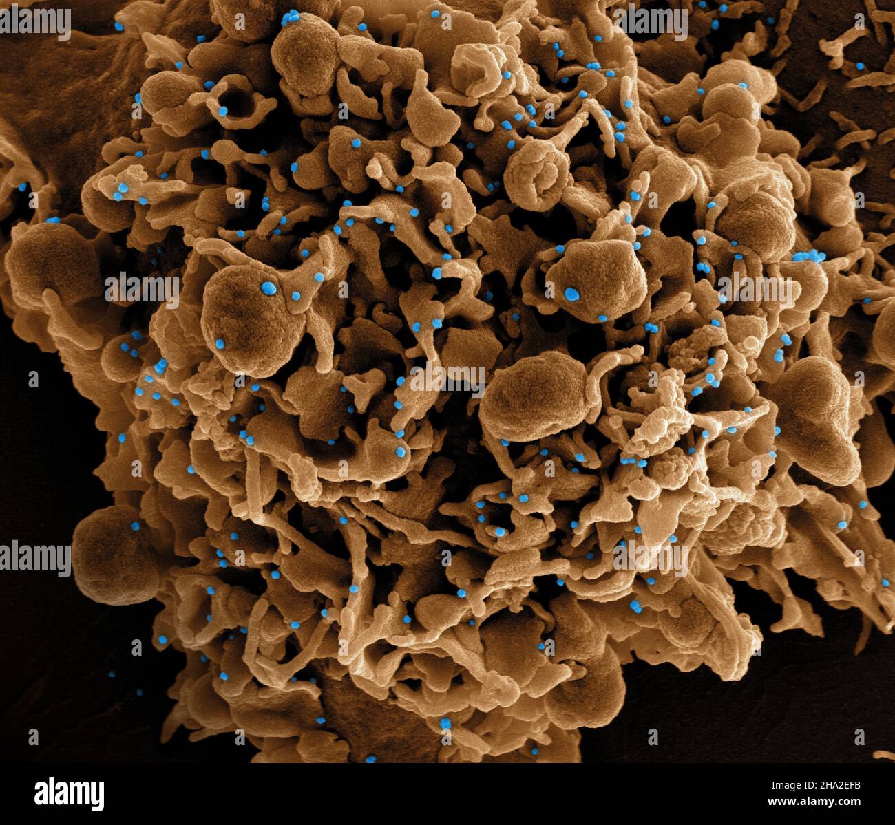 Colorized scanning electron micrograph of a cell (brown) infected with ...