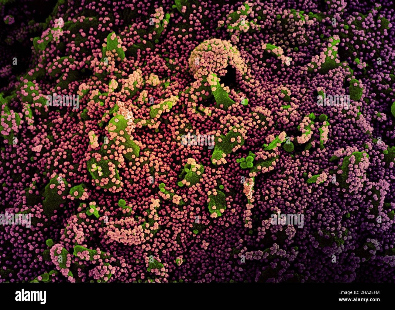 Colorized scanning electron micrograph of a cell (green) heavily ...