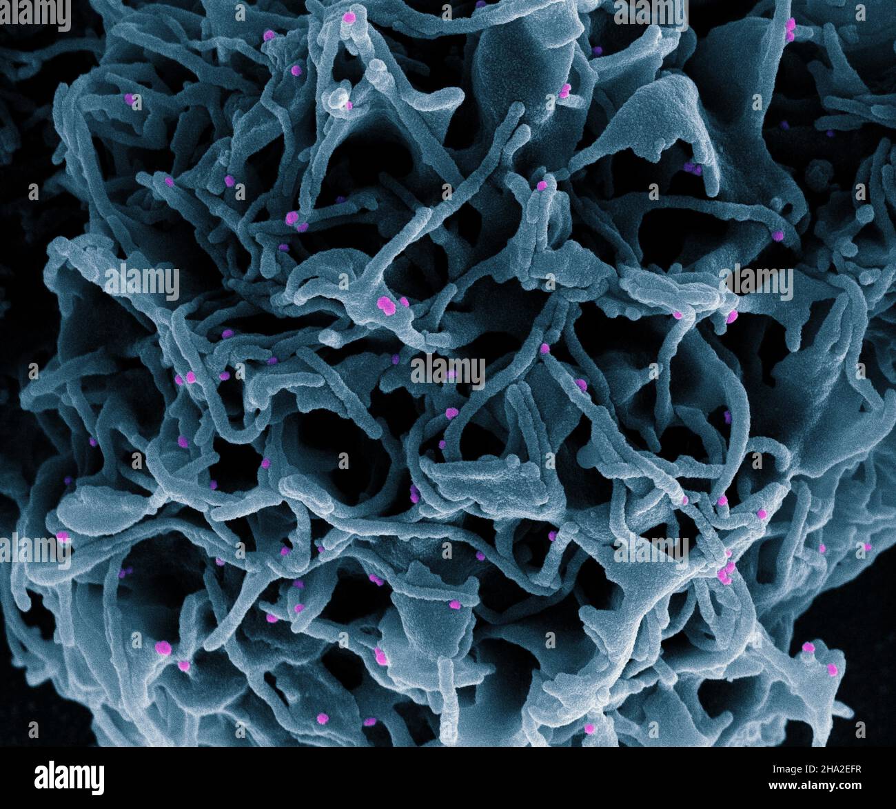 Colorized scanning electron micrograph of a cell (blue) infected with ...