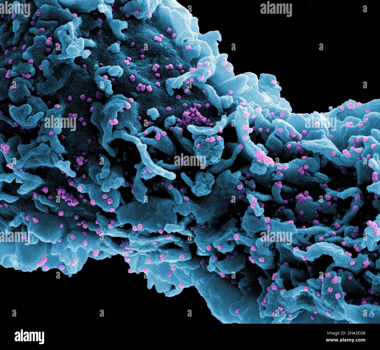 Colorized scanning electron micrograph of a cell (blue) infected with a ...