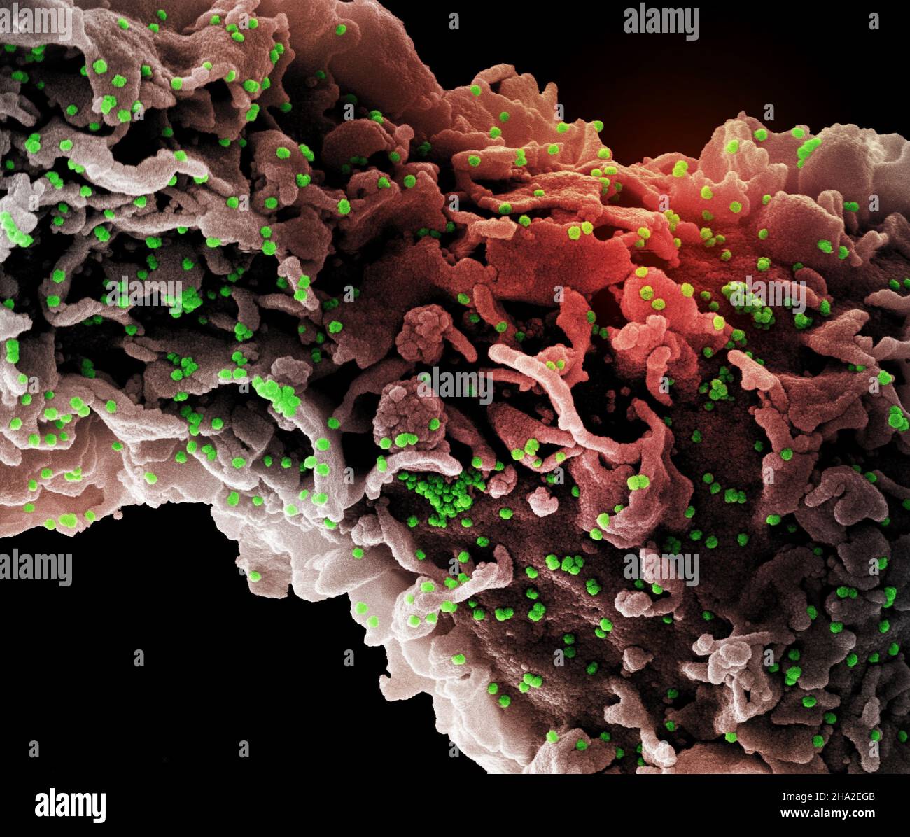Colorized scanning electron micrograph of a cell (gray) infected with a ...