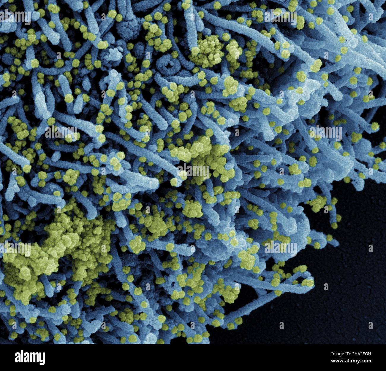 Colorized scanning electron micrograph of a cell (blue) infected with a ...