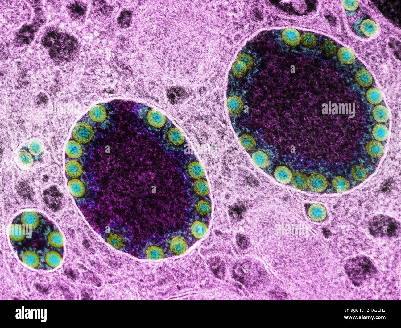Endosomes hi-res stock photography and images - Alamy