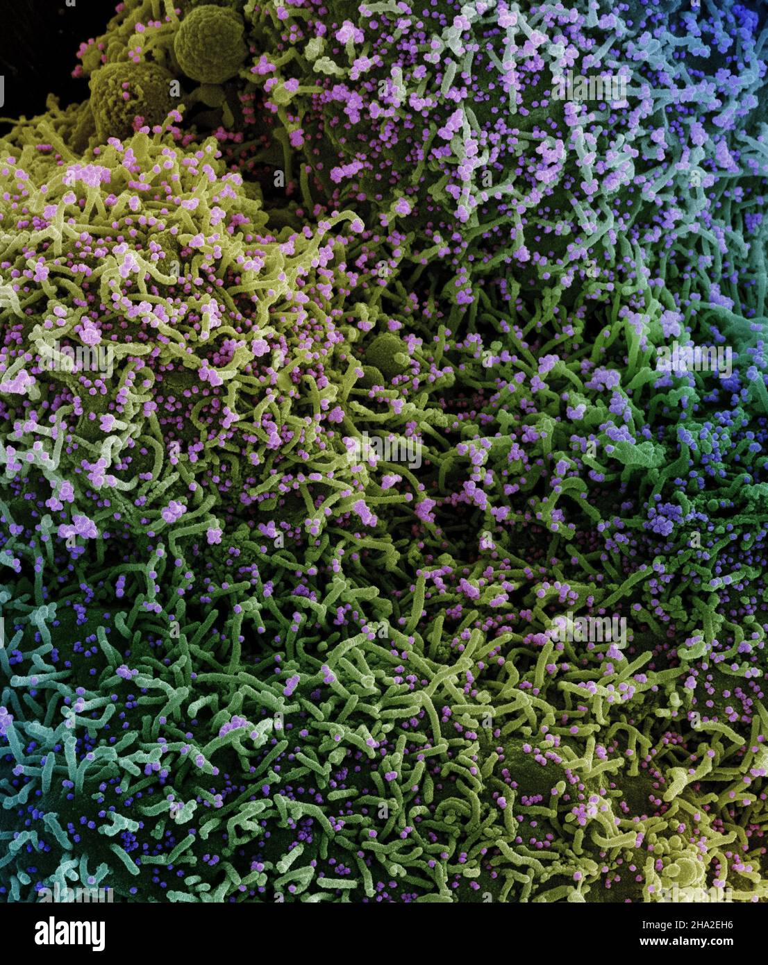 Colorized scanning electron micrograph of a cell (green) infected with ...