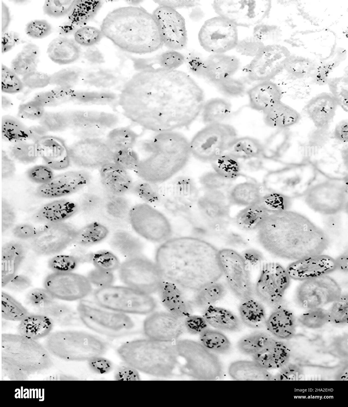 Chlamydiae hi-res stock photography and images - Alamy