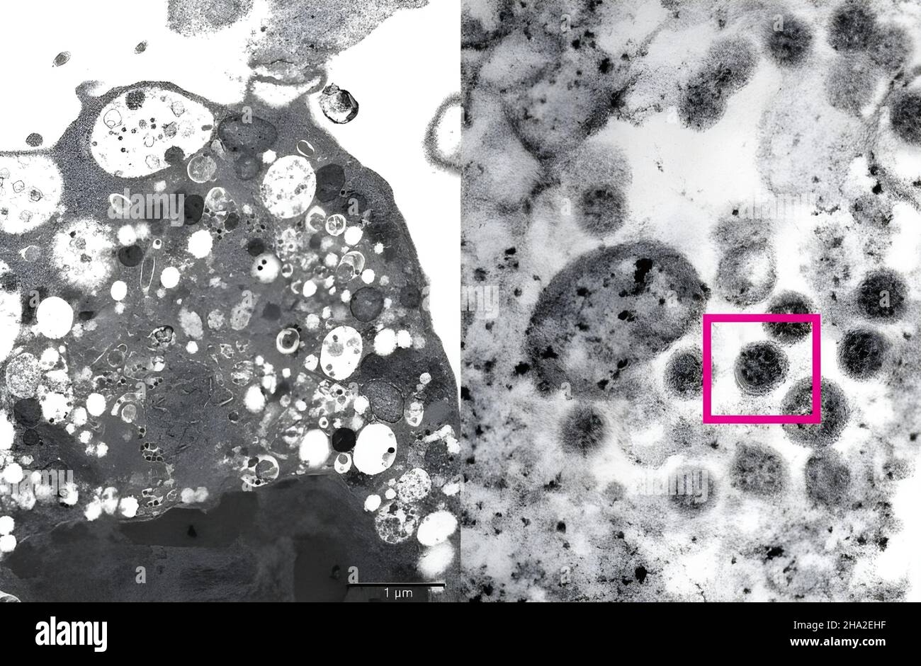 Omicrón hi-res stock photography and images - Alamy